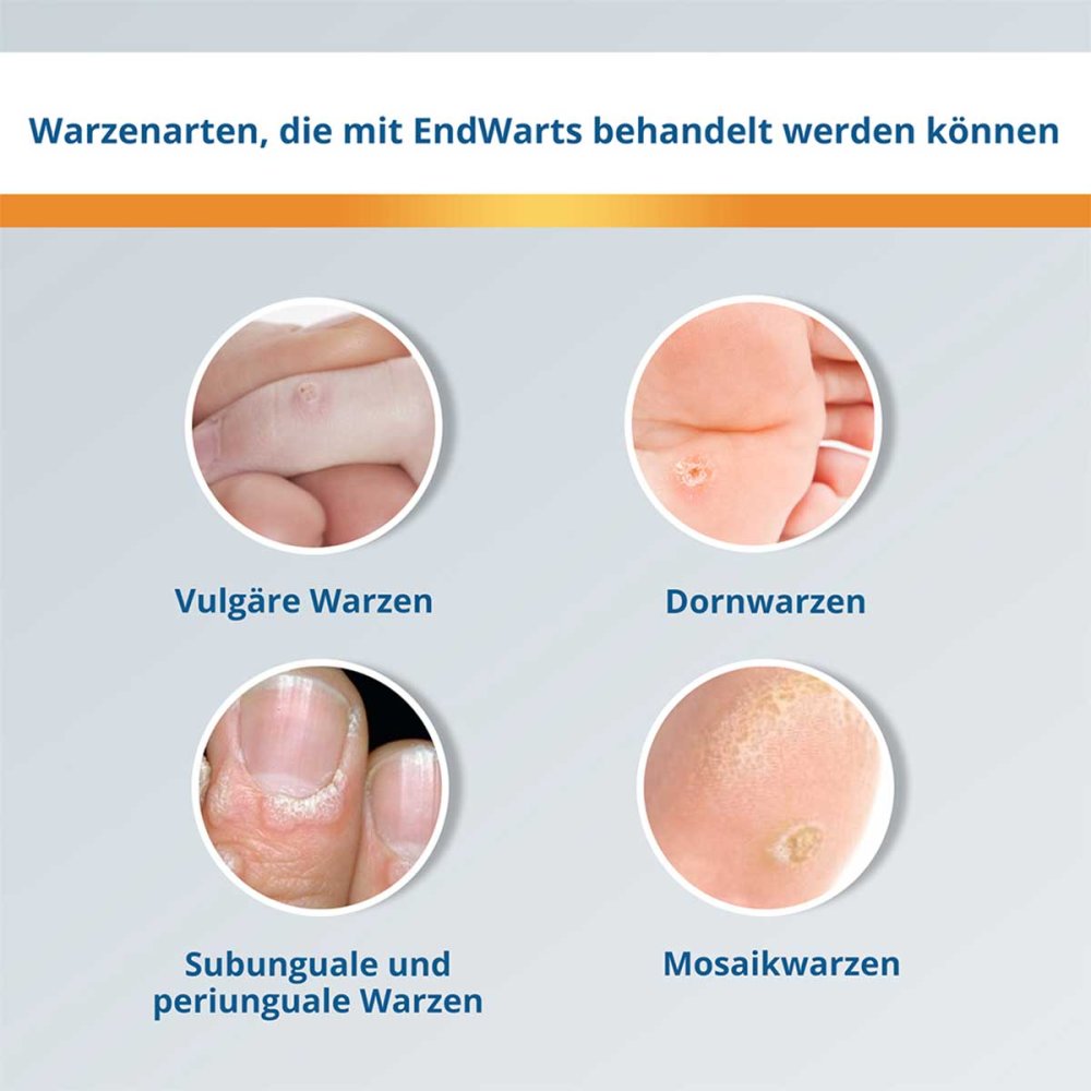 EndWarts FREEZE: Warzen & Dornwarzen durch Vereisung entfernen 7.5 g